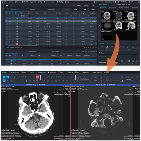 Cloud-based PACS workstation
