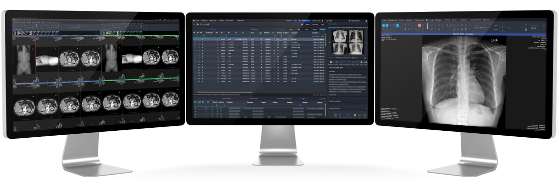 PACS with feature of dual monitor setting
